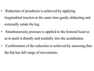 Hemiarthroplasty of Hip joint | PPTX