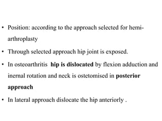 Hemiarthroplasty of Hip joint | PPTX