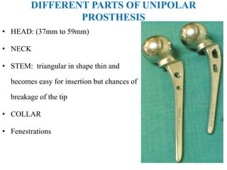Bipolar Hemiarthroplasty Vs Unipolar Hemiarthroplasty