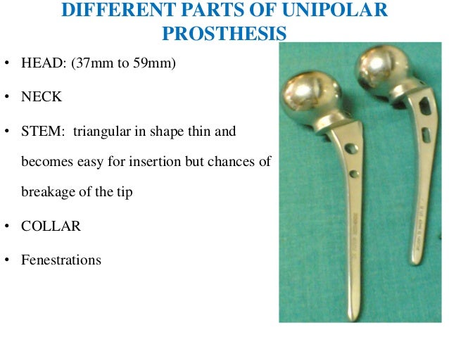Hemiarthroplasty of Hip joint