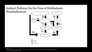 Hemiballismus | PPTX