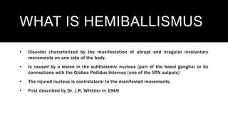 Hemiballismus | PPT