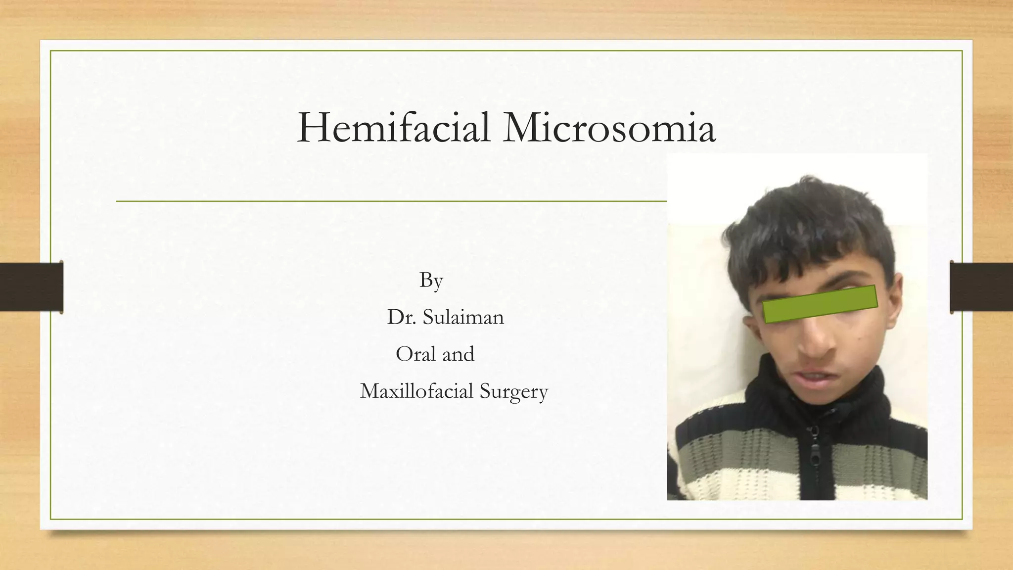 Hemifacial microsomia | PPTX
