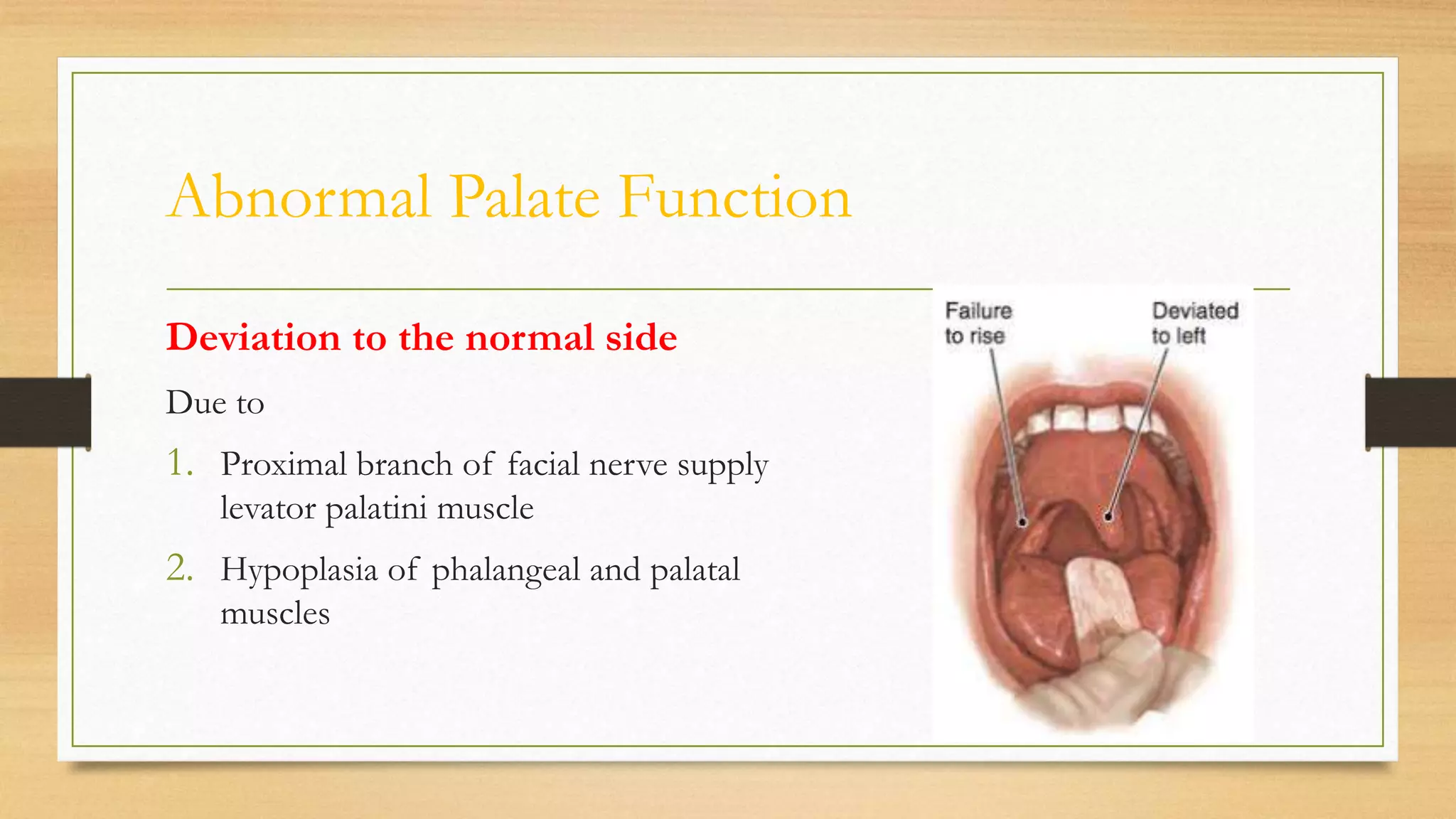 Hemifacial microsomia | PPTX