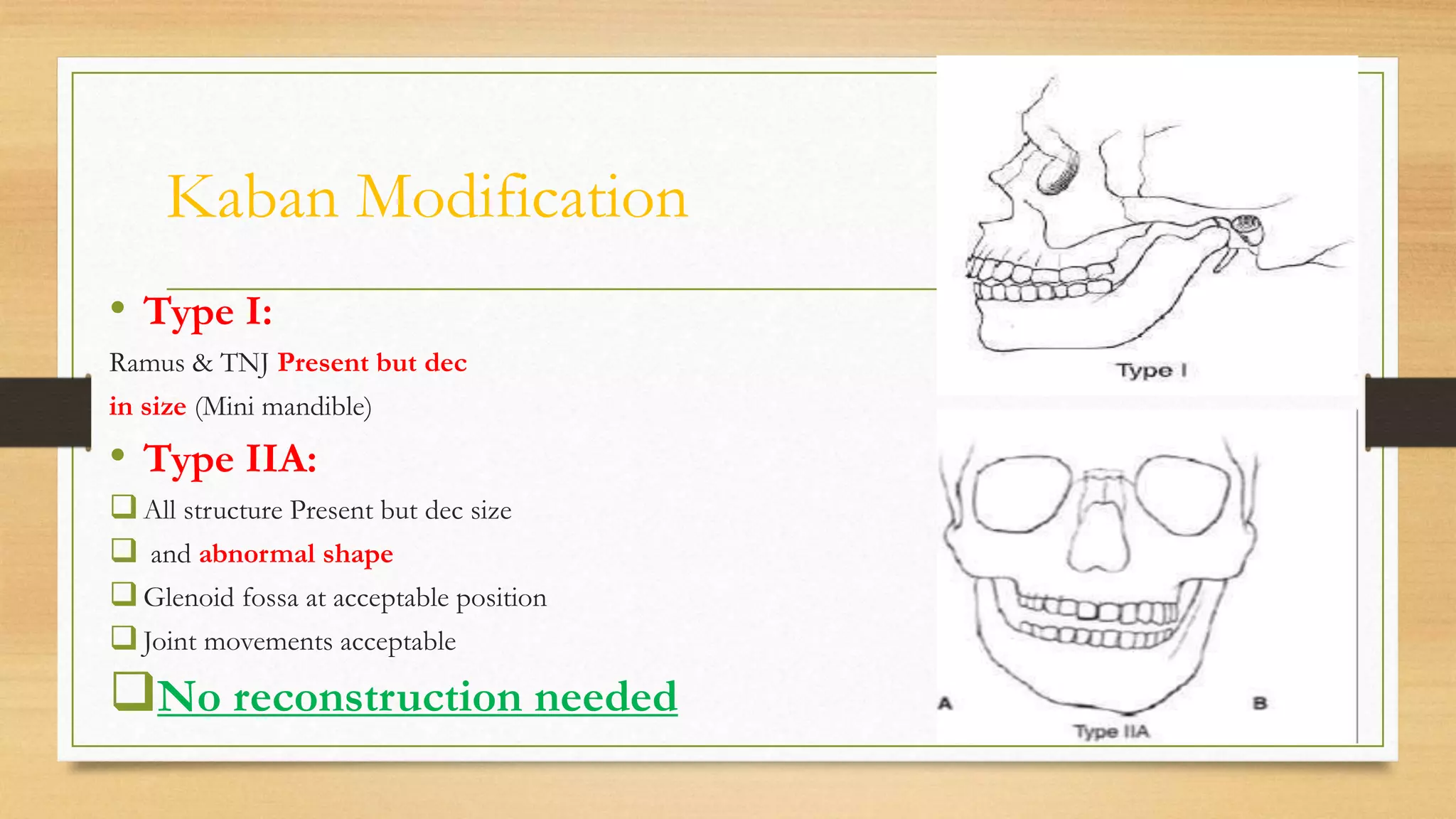 Hemifacial microsomia | PPTX