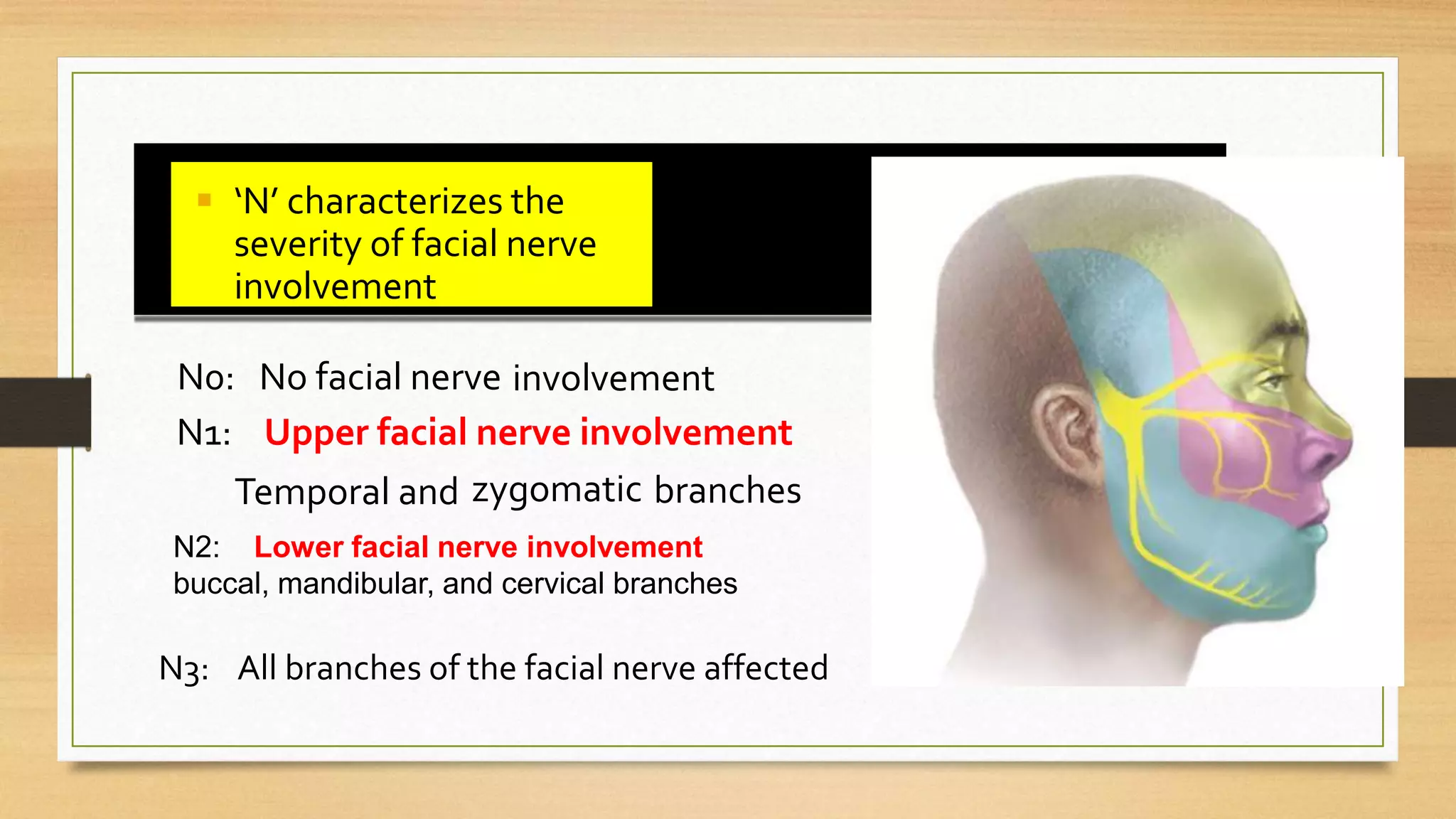 Hemifacial microsomia | PPTX