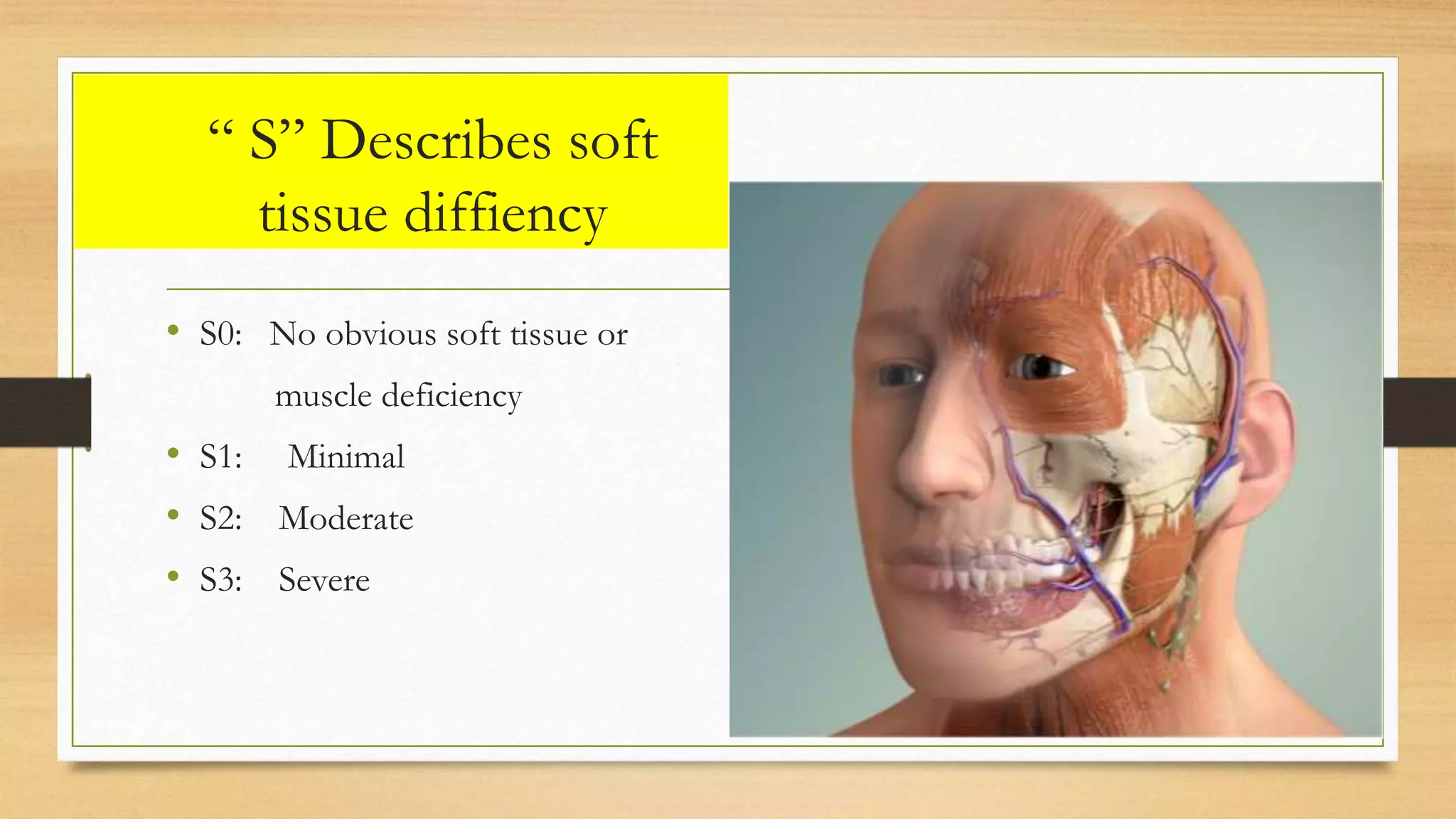 Hemifacial microsomia | PPTX