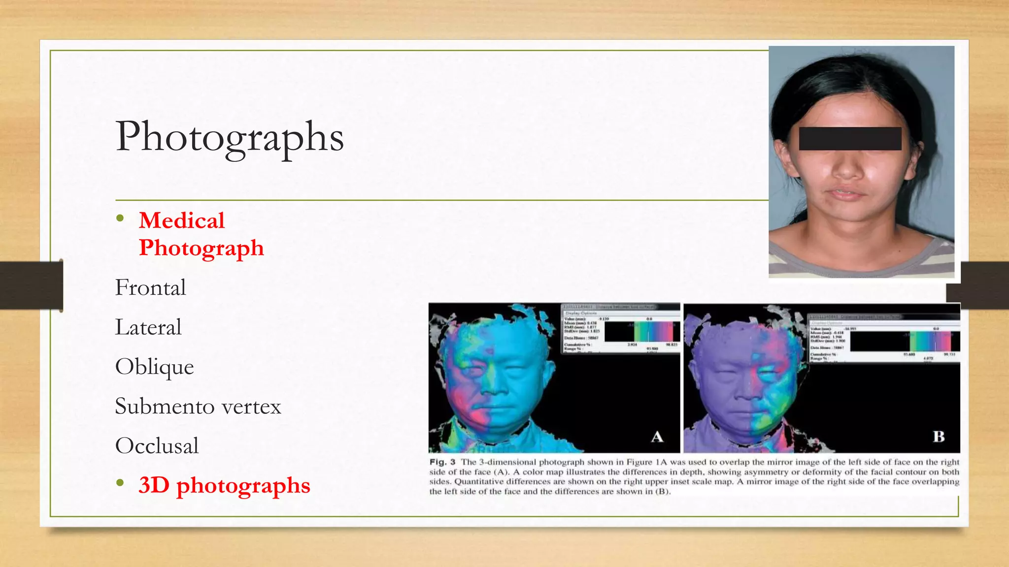 Hemifacial microsomia | PPTX