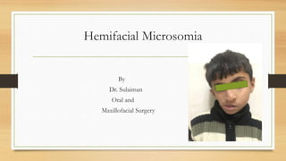 Hemifacial microsomia | PPTX