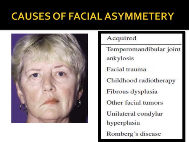 HEMIFACIAL MICROSOMIA DR VIPIN V NAIR | PPTX | Ear, Nose and Throat ...