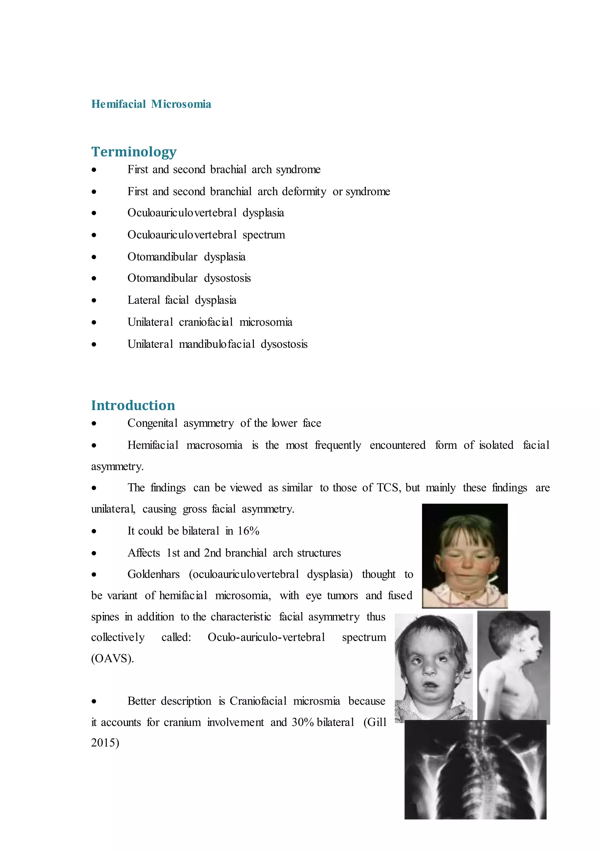 Hemifacial microsomia: goldenhar’s syndrome for orthodontist by ...