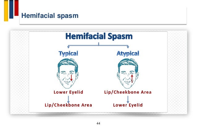 Hemifacial spasm