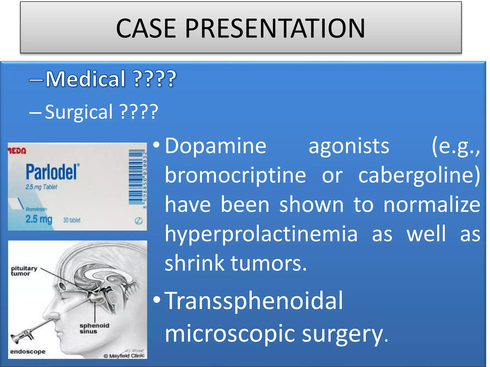 Hemifeild sliding phenomenon | PPTX