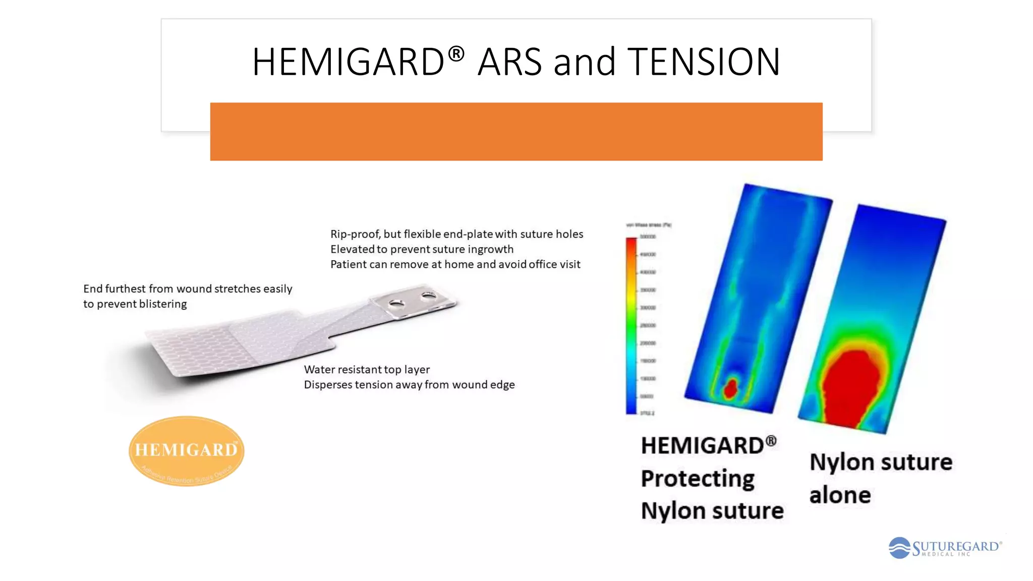 HEMIGARD ARS Device - Close More Wounds, More Simply | PPT