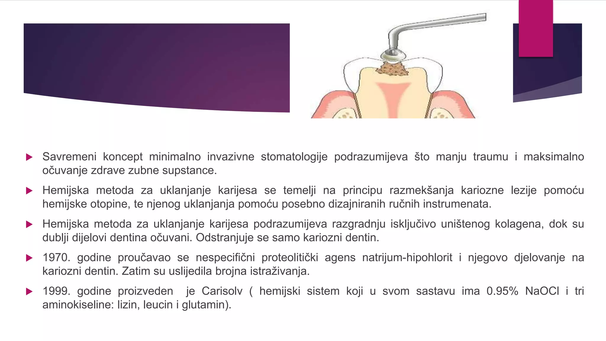 Hemijske metode za uklanjanje karijesa | PPTX
