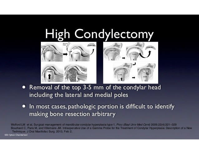 Hemimandibular hyperplasia and facial asymmetry