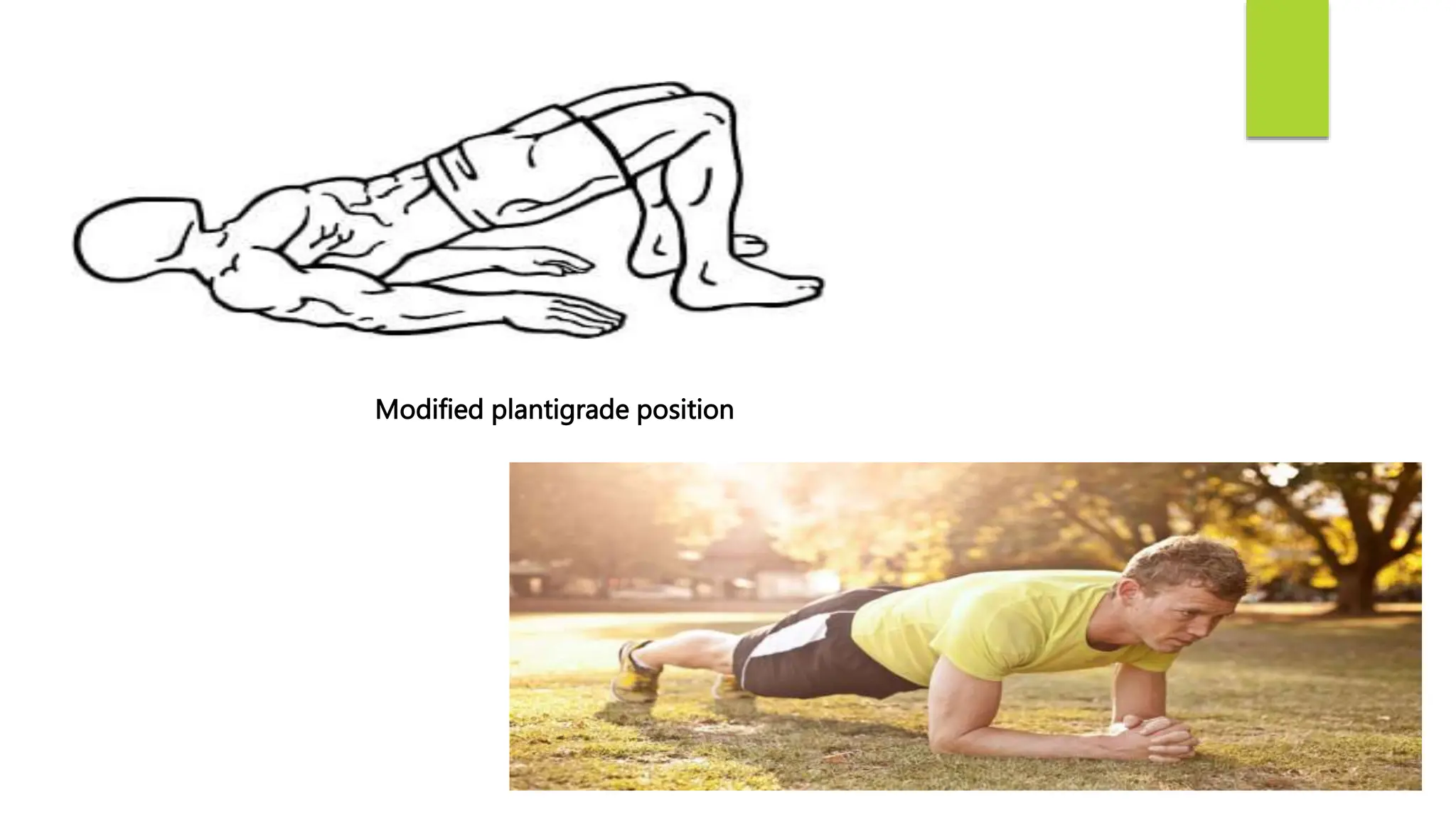 Hemiparesis - case presentation.pptx