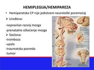 HEMIPAREZA.pptx
