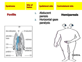 Hemiplegia | PDF