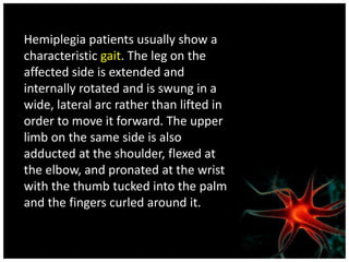 Hemiplegia (1) | PPT