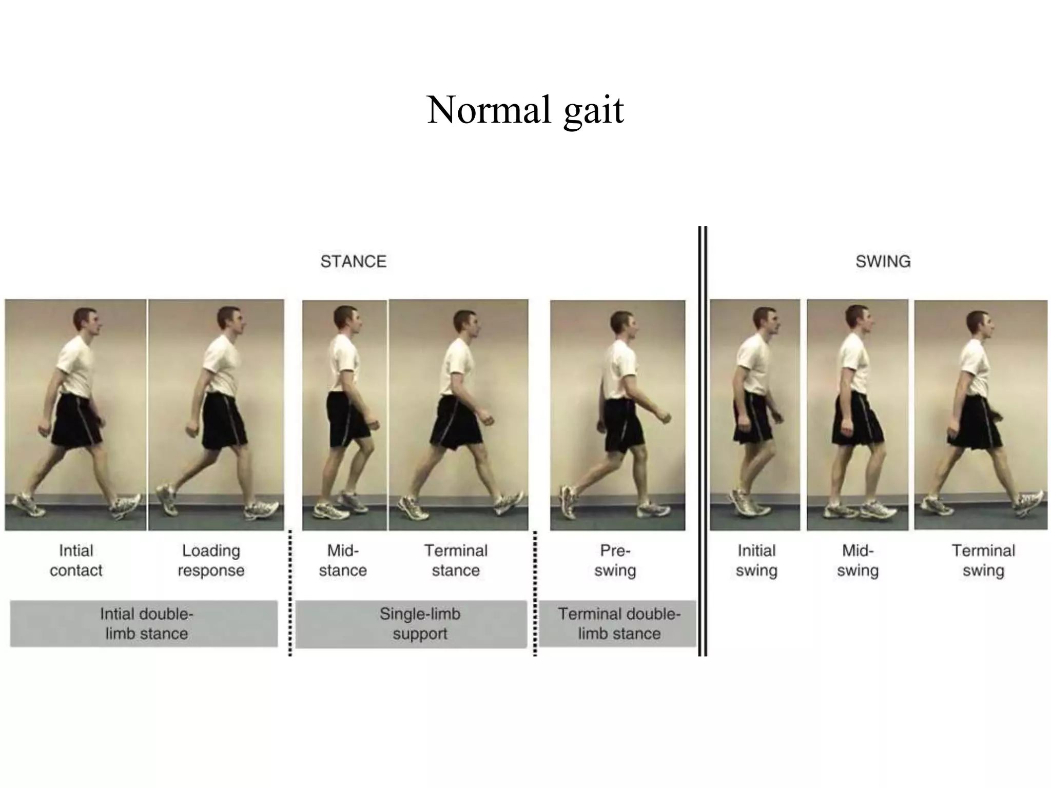 Hemiplegic gait | PPTX