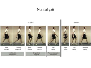 Hemiplegic gait | PPTX
