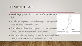 Hemiplegic Gait Rehabilitation | PPTX