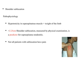 Hemiplegic Shoulder | PPTX