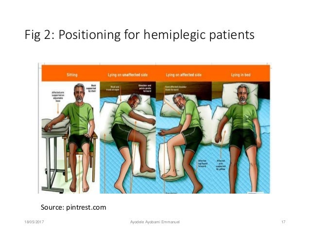 Prevention and management of hemiplegic shoulder pain among stroke su…