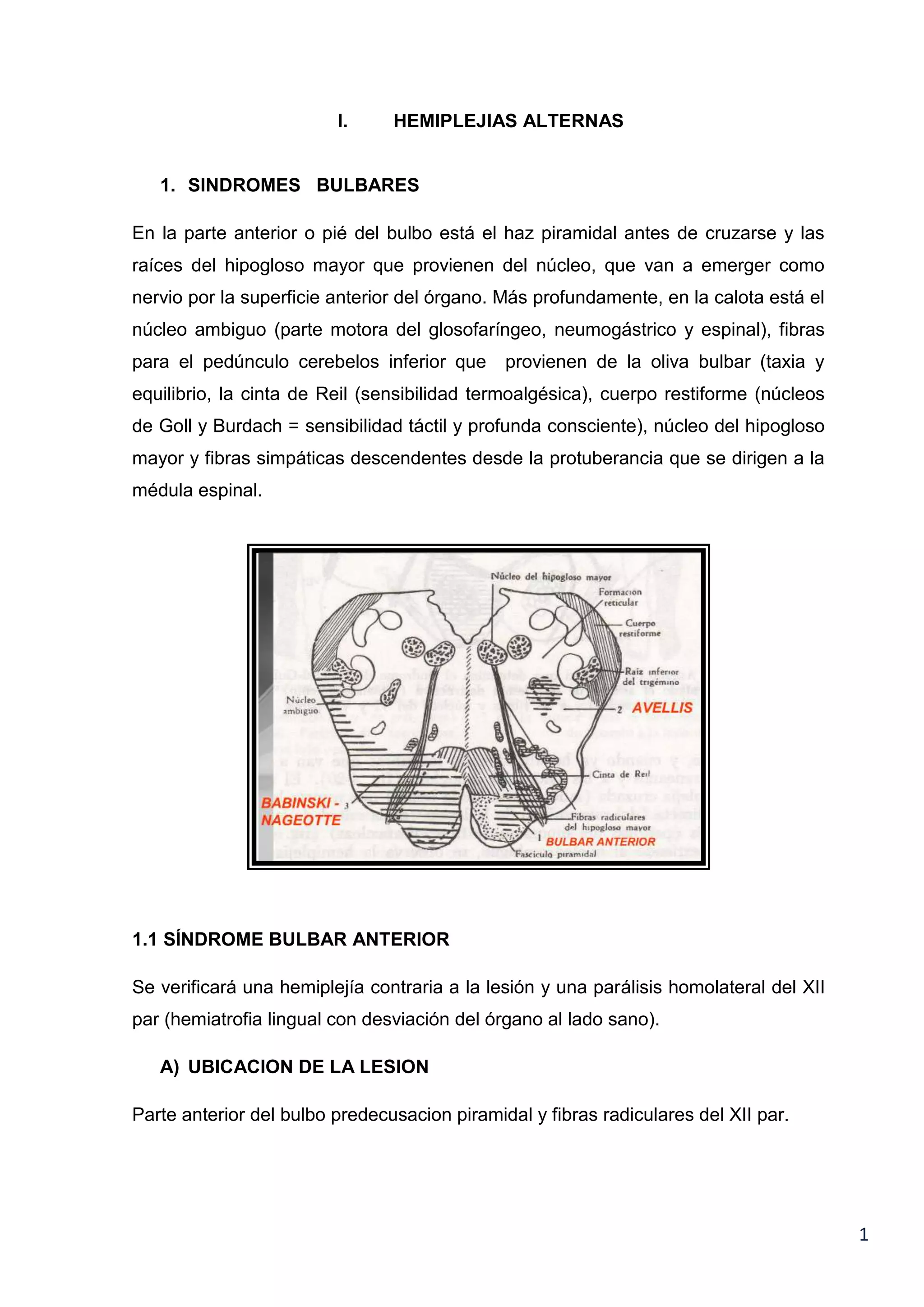 Hemiplejias alternas | DOCX