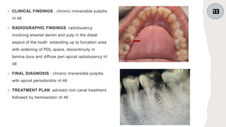 resection for conservation HEMISECTION.. | PPTX
