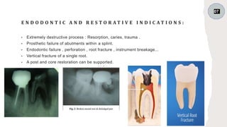 resection for conservation HEMISECTION.. | PPTX