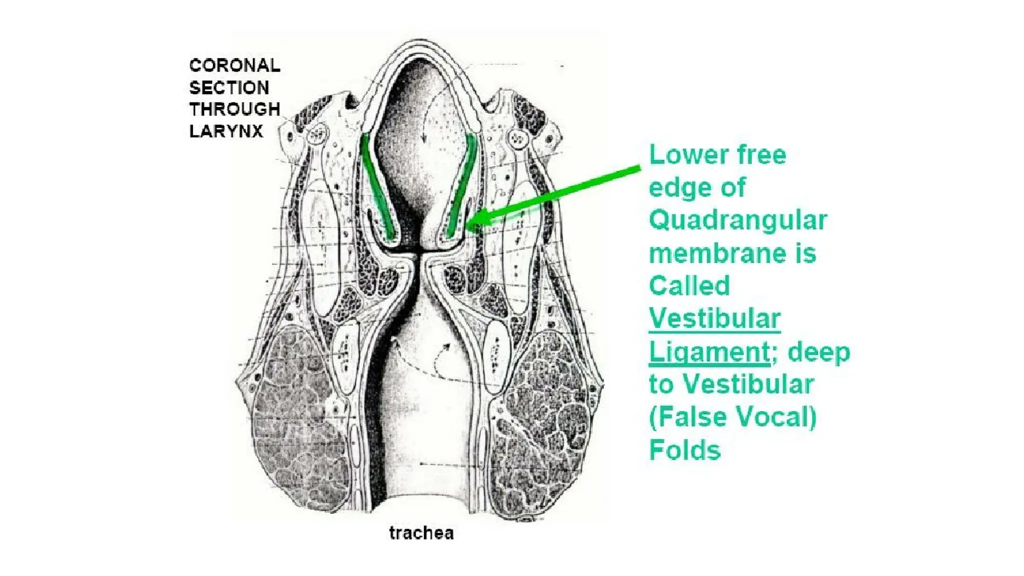 HEMISECTION OF HEAD AND NECK WITH CLINICAL ANATOMY.pptx