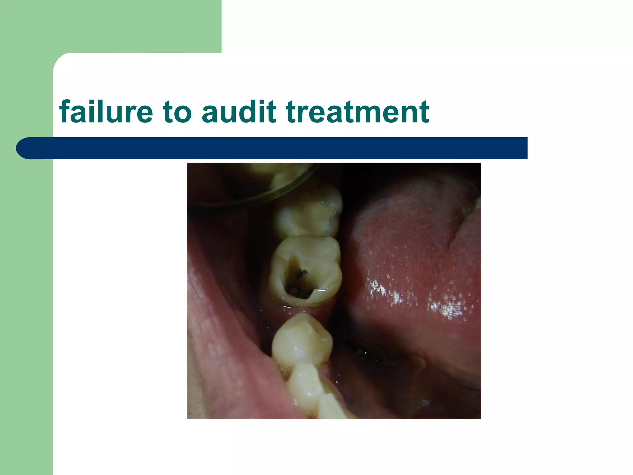 Hemisections teeth 46 | PPT