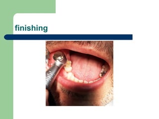 Hemisections teeth 46 | PPT
