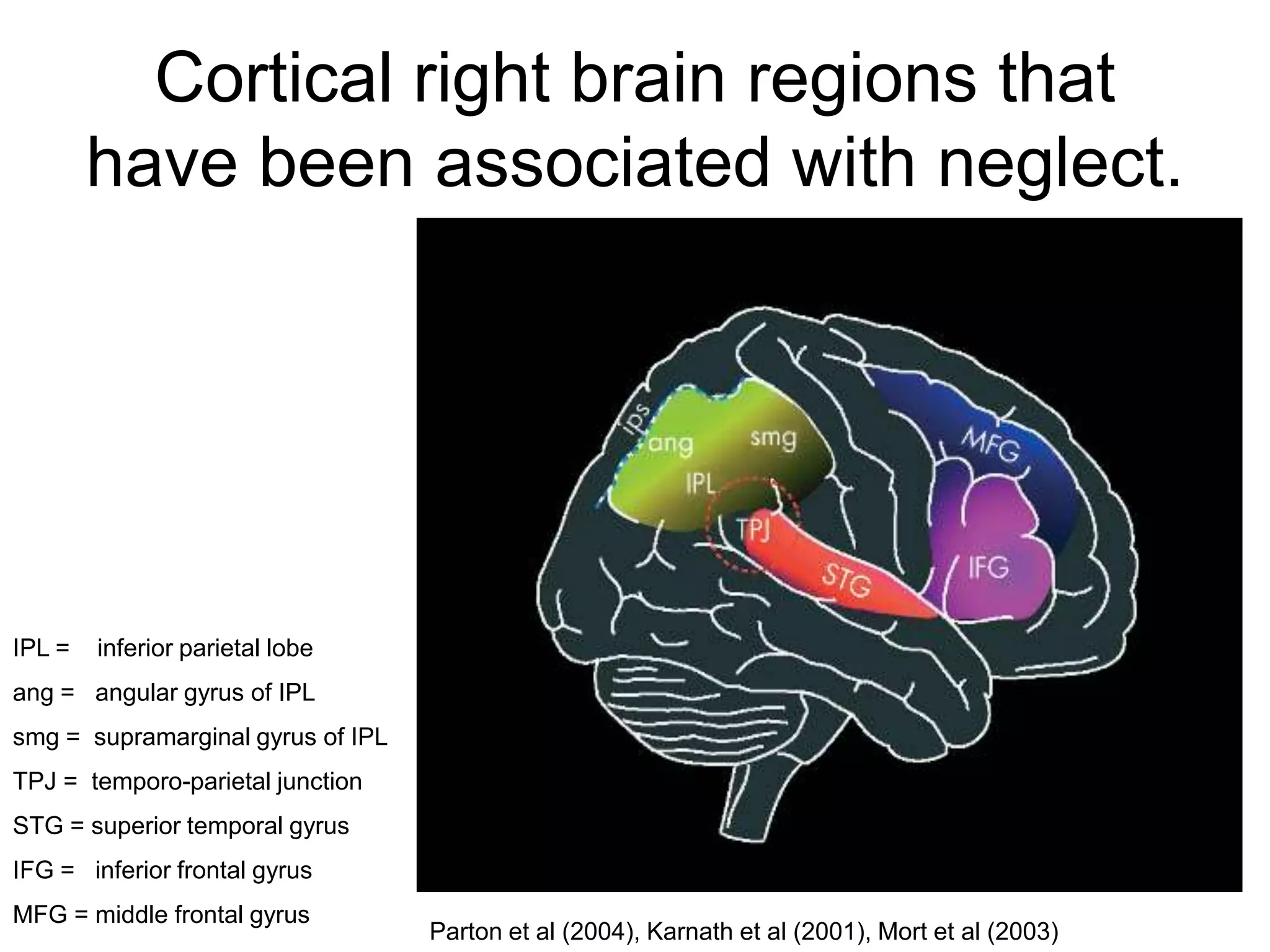 Hemispatial neglect2007 | PPTX