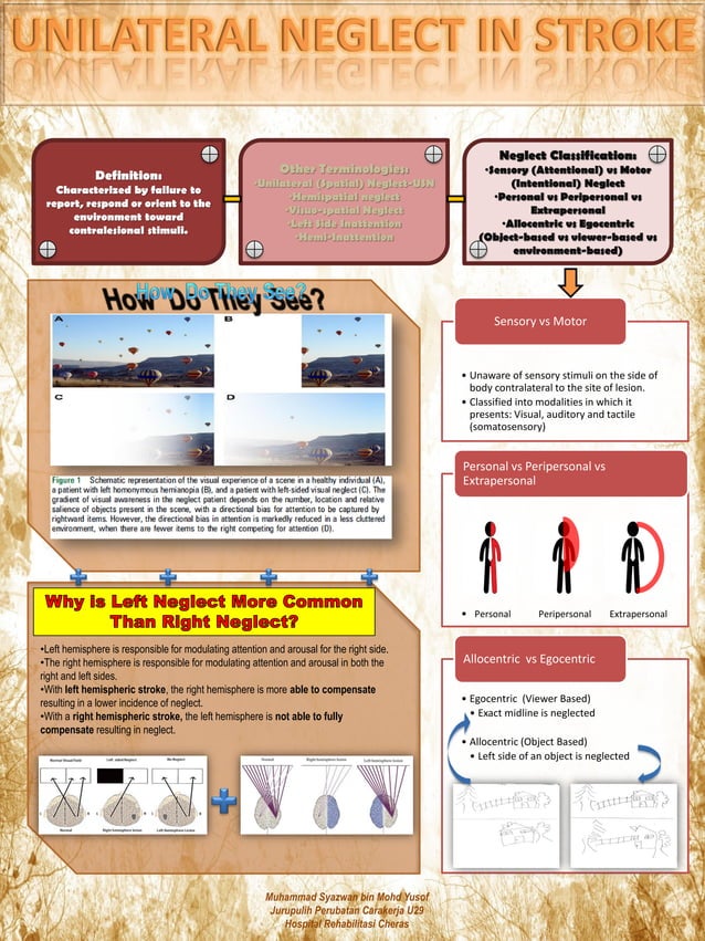 Hemispatial neglect syazwan | PDF