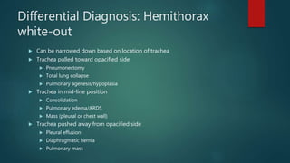 Hemithorax white out (1) | PPTX | Lung and Respiratory Health ...