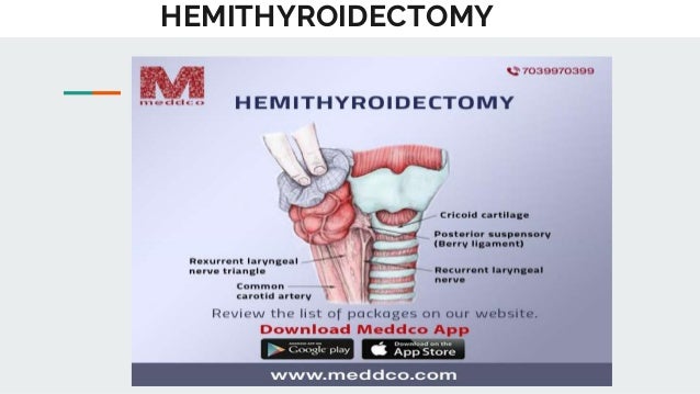 Hemithyroidectomy | PPTX