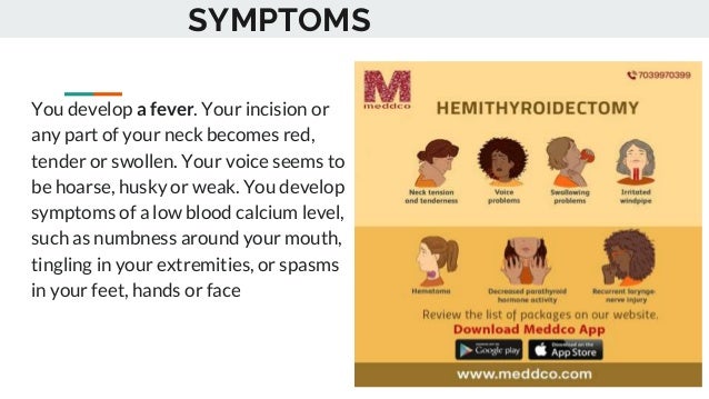 Hemithyroidectomy | PPTX