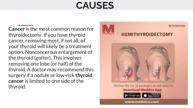 Hemithyroidectomy | PPTX