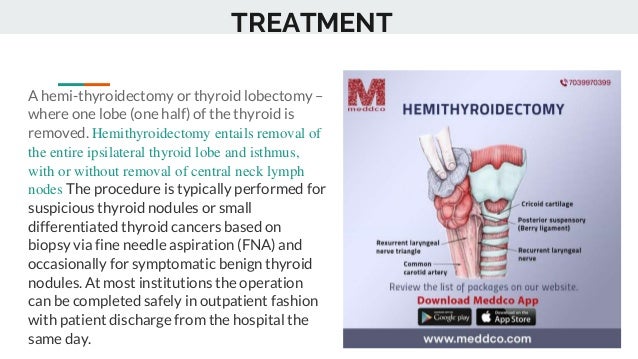 Hemithyroidectomy | PPTX