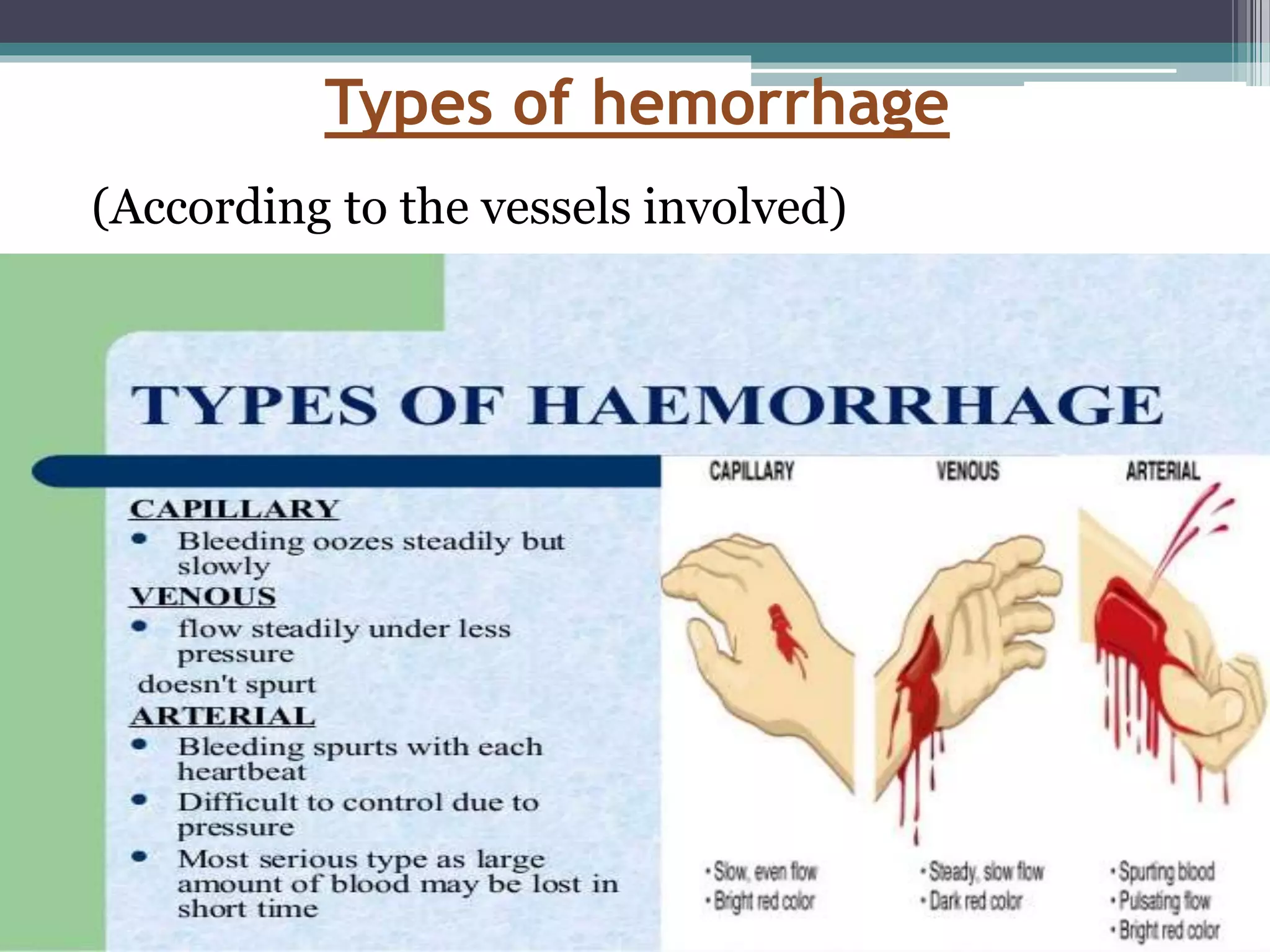 Hemmorrhage and shock | PPTX