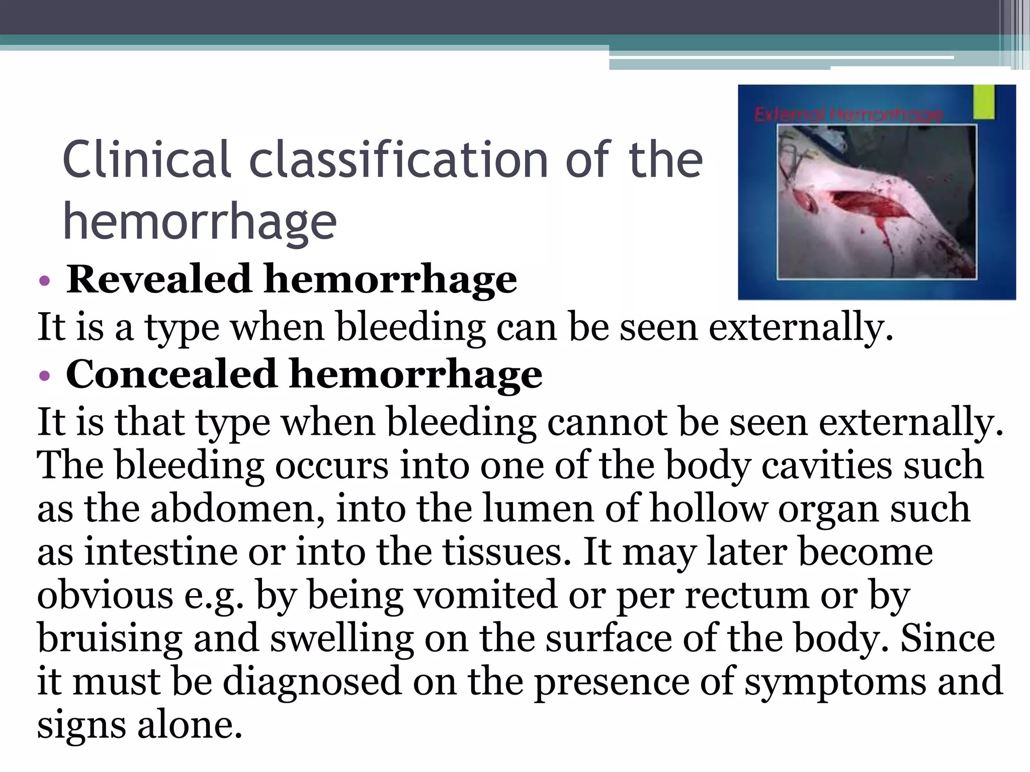 Hemmorrhage and shock | PPTX