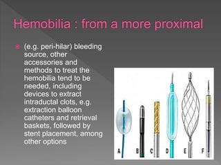 Hemobilia | PPTX