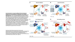 Hemochromatosis (1)m.pptx
