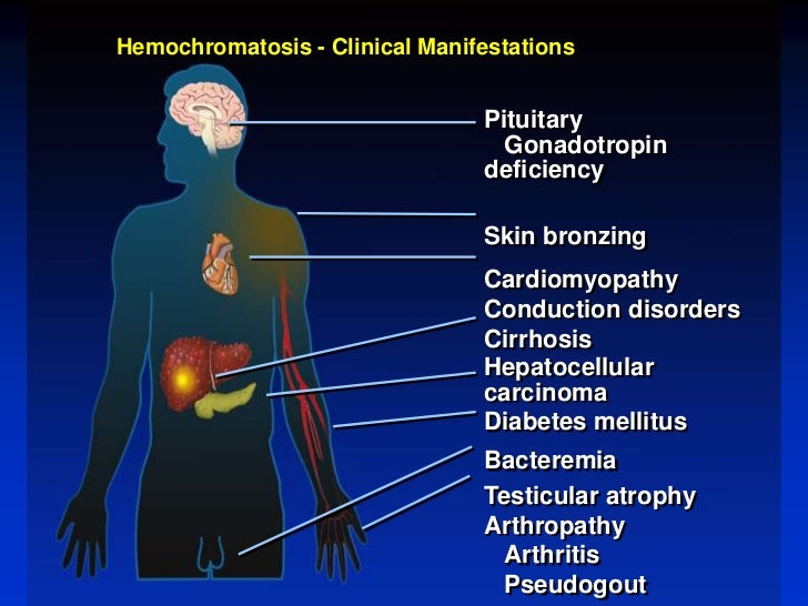 Hemochromatosis talk pramod mistry