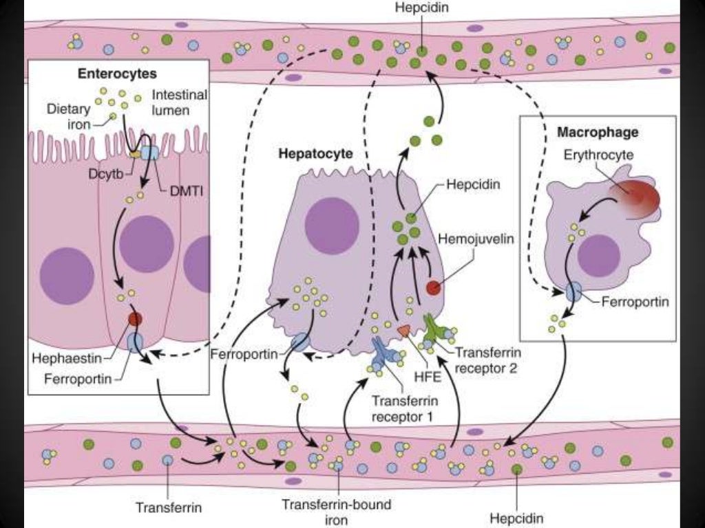 Hemocromatosis
