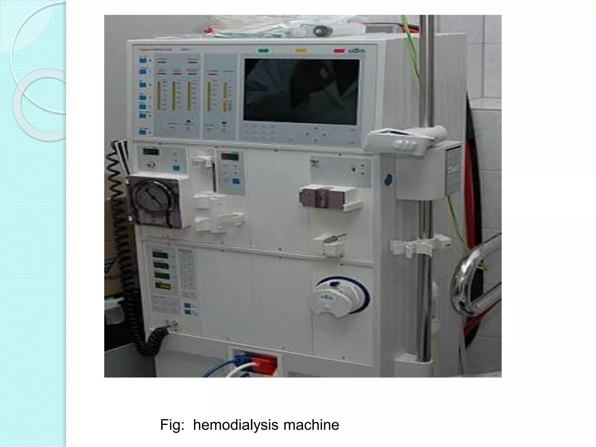 Hemodialysis | PPTX