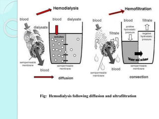 Hemodialysis | PPTX